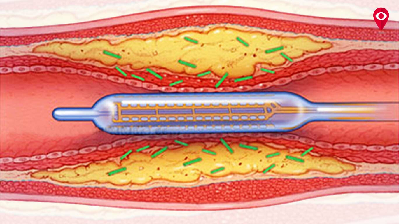 FDA show causes three major hospitals for catheter reuse